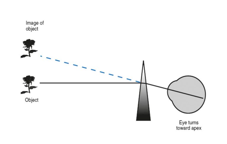 Prisma y efecto prismático: Tema menospreciado en la rutina clínica - Vision y Óptica